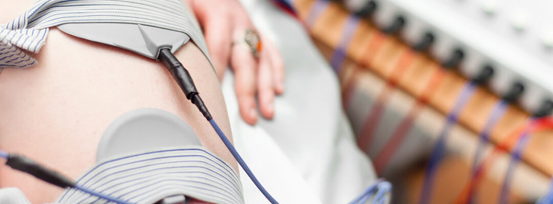Electromiograma o electromiografía para los músculos -canalSALUD